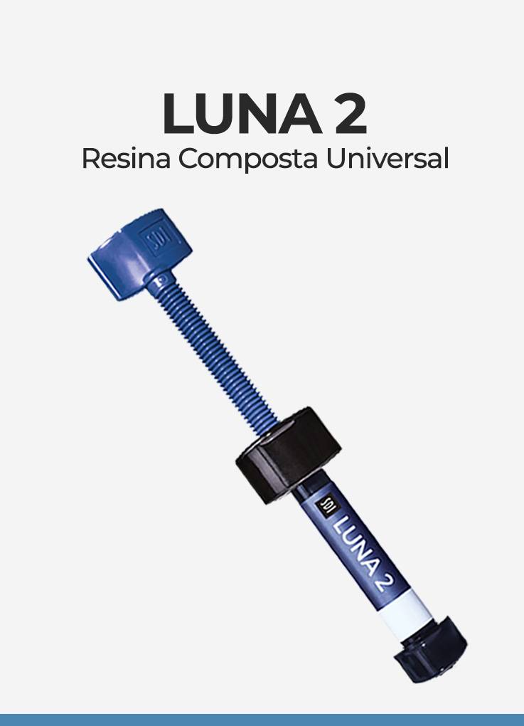 Facetas diretas com Luna 2 - SDI Odonto